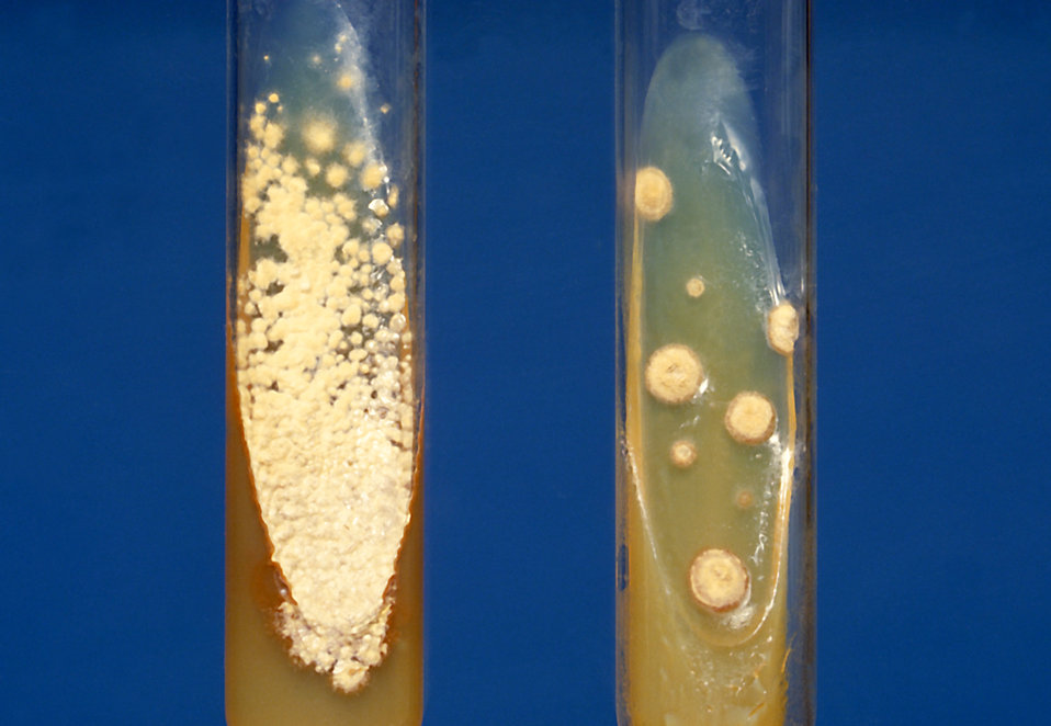 Public Domain Picture These Two Slant Cultures Grew Histoplasma Capsulatum Colonies Lt Tube 
