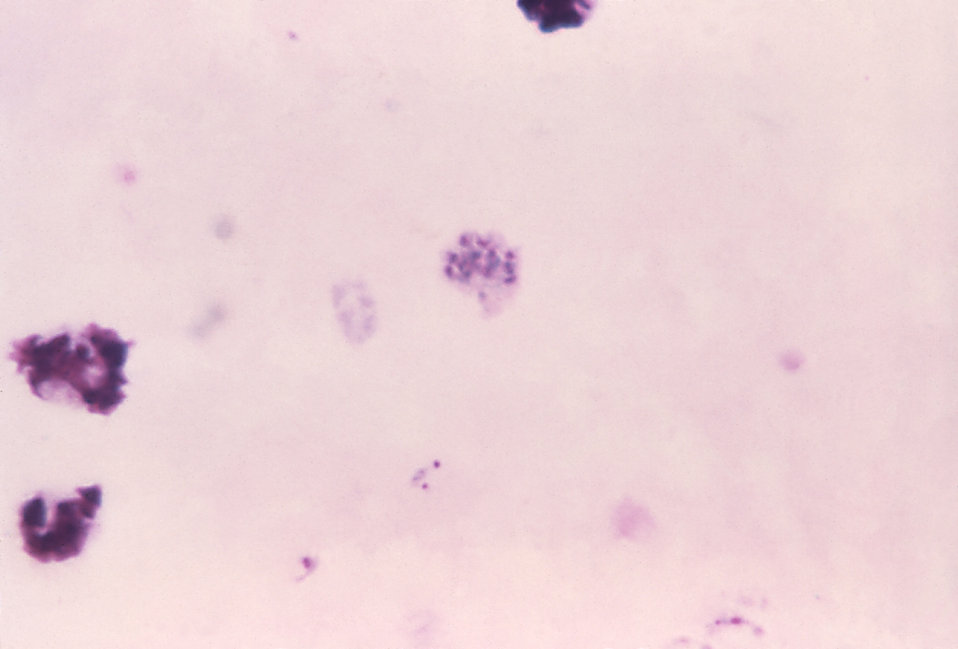 Public Domain Picture | This thick film micrograph depicts a mature ...