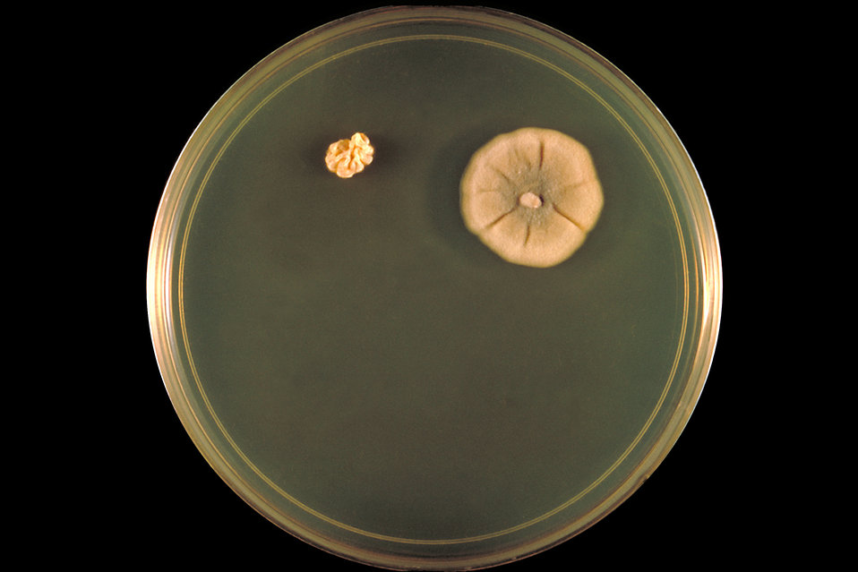 Public Domain Picture | This image shows a C&C agar plate culture with ...