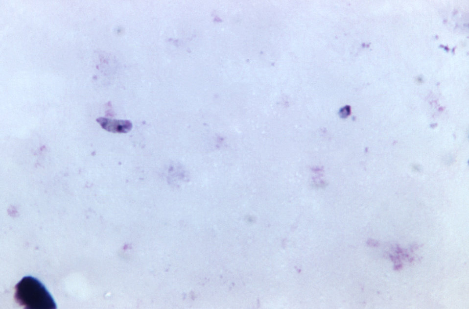 Public Domain Picture | This micrograph shows two species of malarial ...