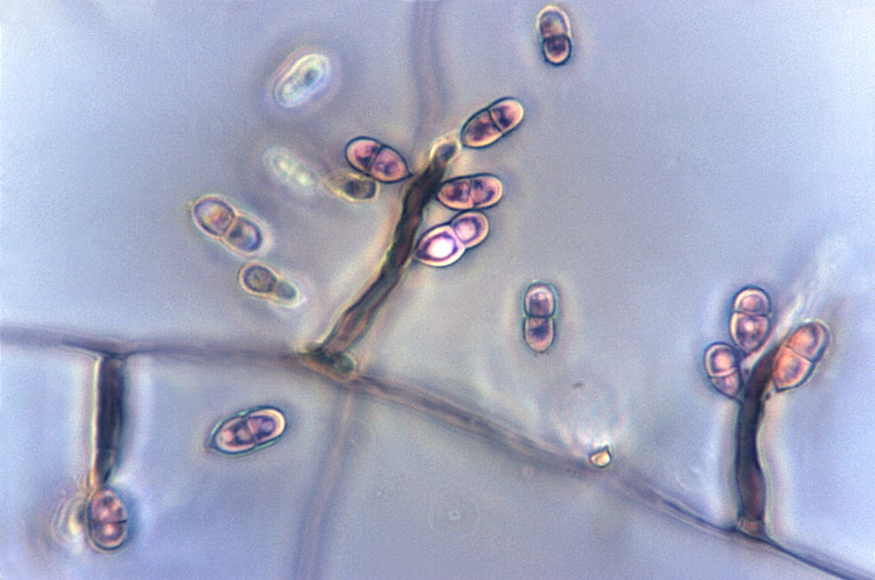 Public Domain Picture | Under a relatively-high magnification of 1125X ...