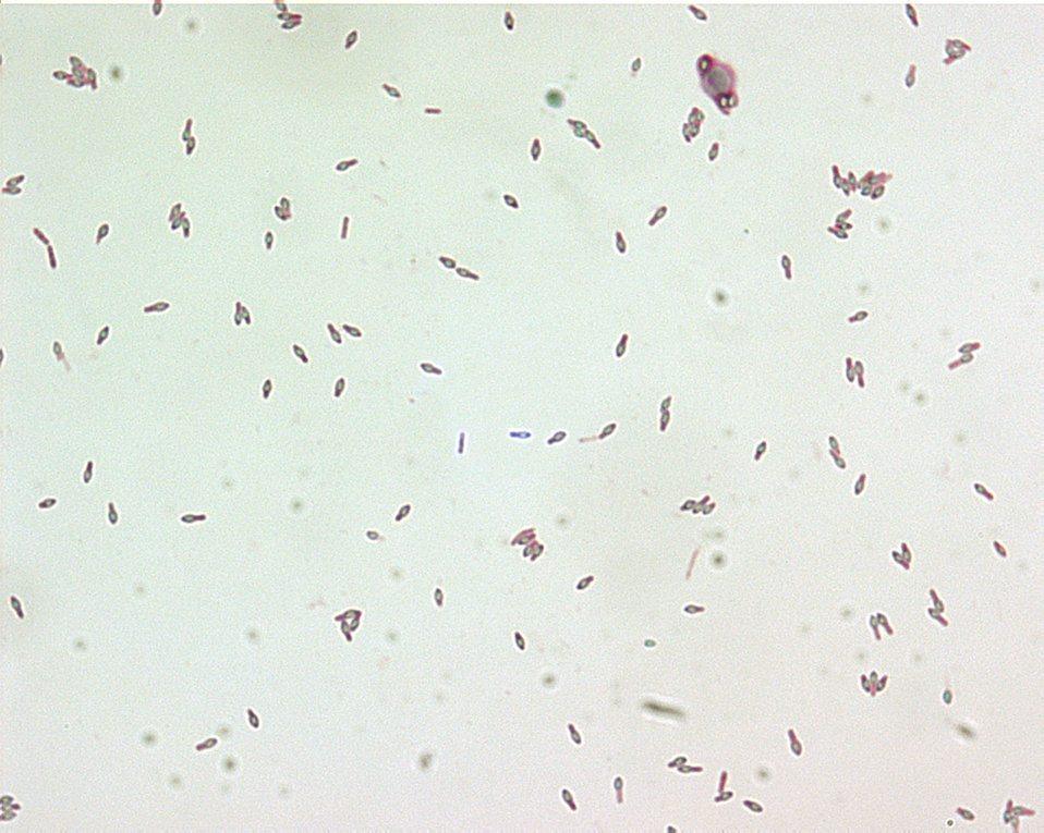 Public Domain Picture | Clostridium botulinum spores stained with ...