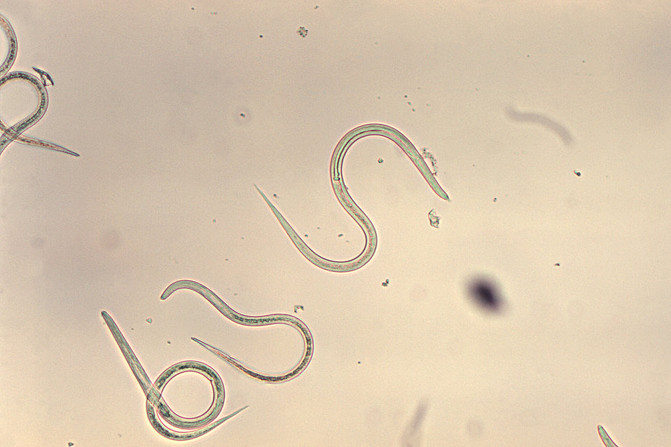 Public Domain Picture | Magnified 100X, this photomicrograph depicted a ...