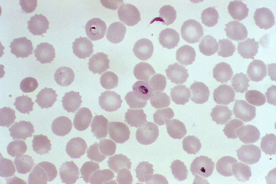 Public Domain Picture | A photomicrograph of a blood smear with ring ...