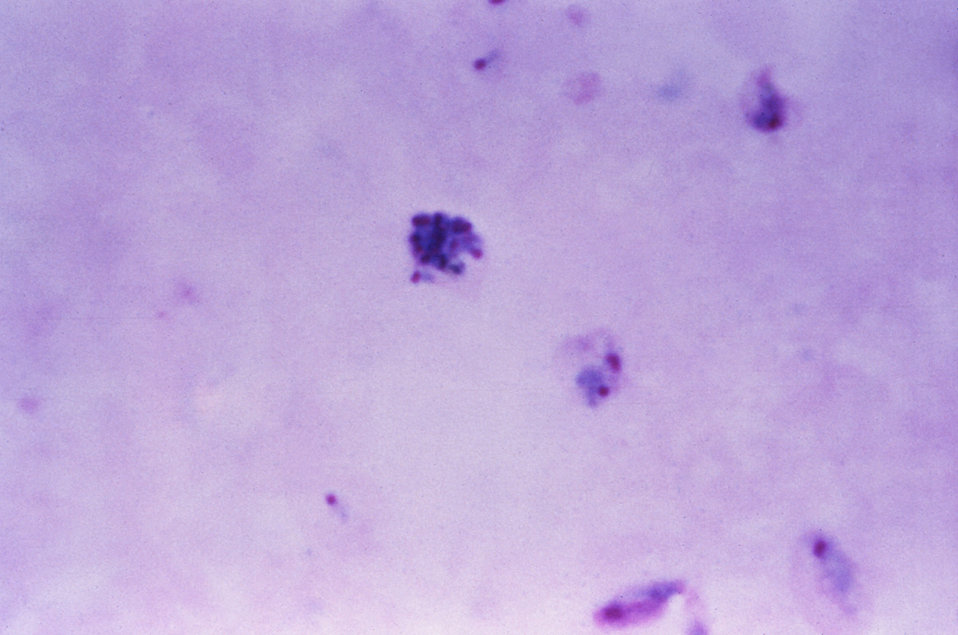 Public Domain Picture | This thick film Giemsa stained micrograph shows ...