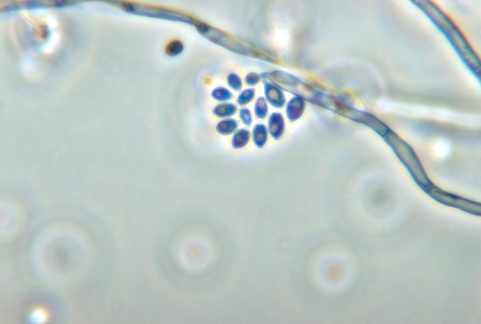 Public Domain Picture | This micrograph depicts the conidia-laden ...